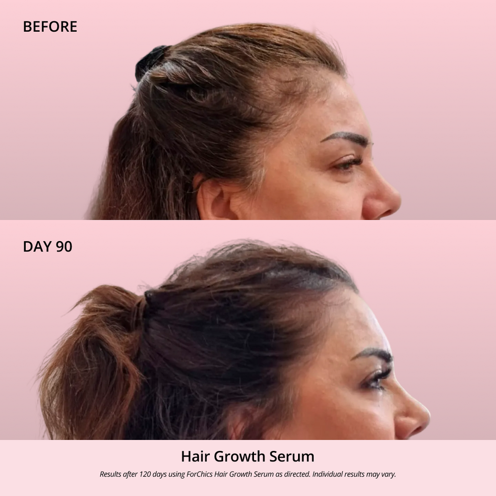 Revive Your Hair Now with Hair Growth Oil Spray | ForChics