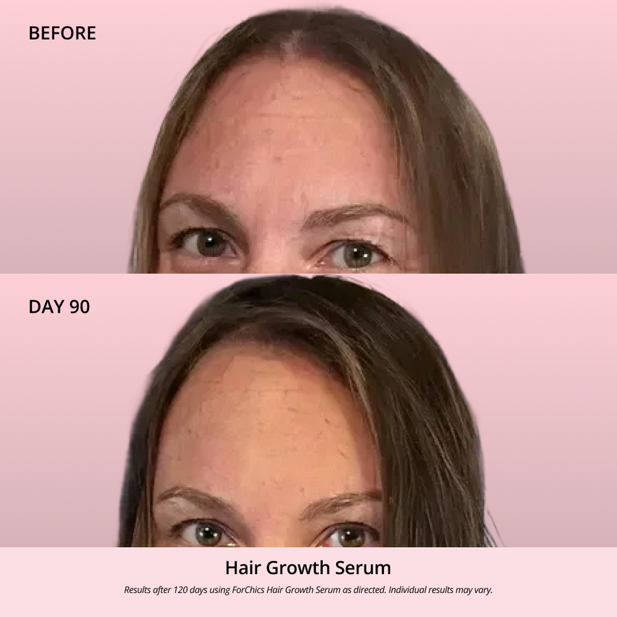 Revive Your Hair Now with Hair Growth Oil Spray | ForChics