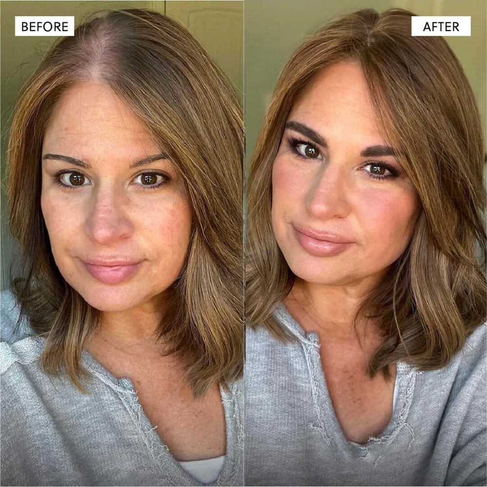 Revive Your Hair Now with Hair Growth Oil Spray | ForChics
