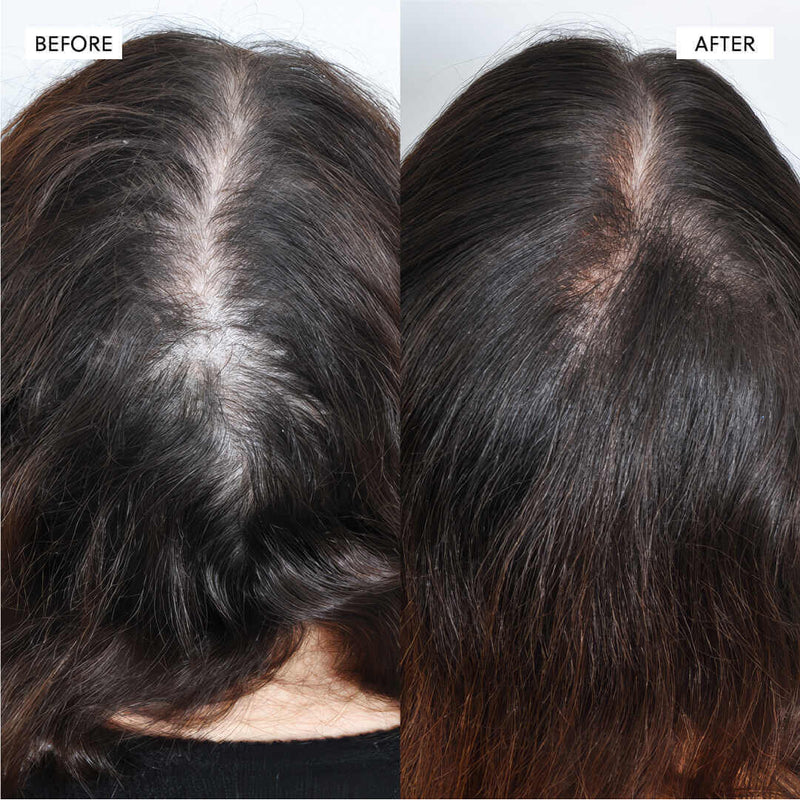 Revive Your Hair Now with Hair Growth Oil Spray | ForChics