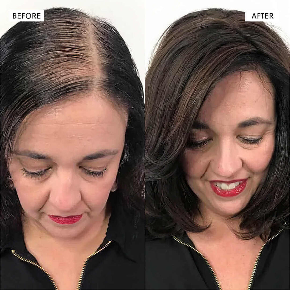 Revive Your Hair Now with Hair Growth Oil Spray | ForChics