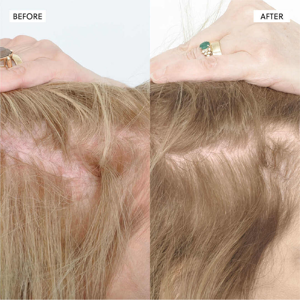 Revive Your Hair Now with Hair Growth Oil Spray | ForChics