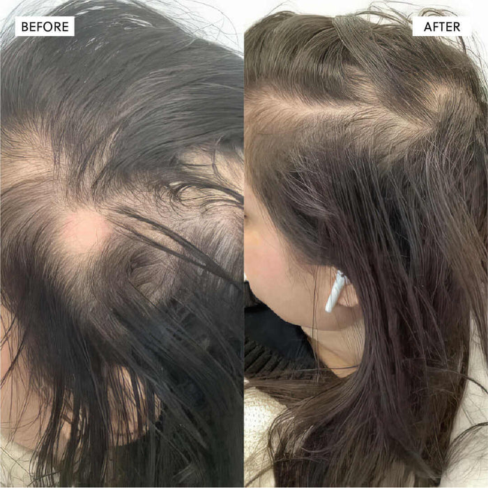 Revive Your Hair Now with Hair Growth Oil Spray | ForChics