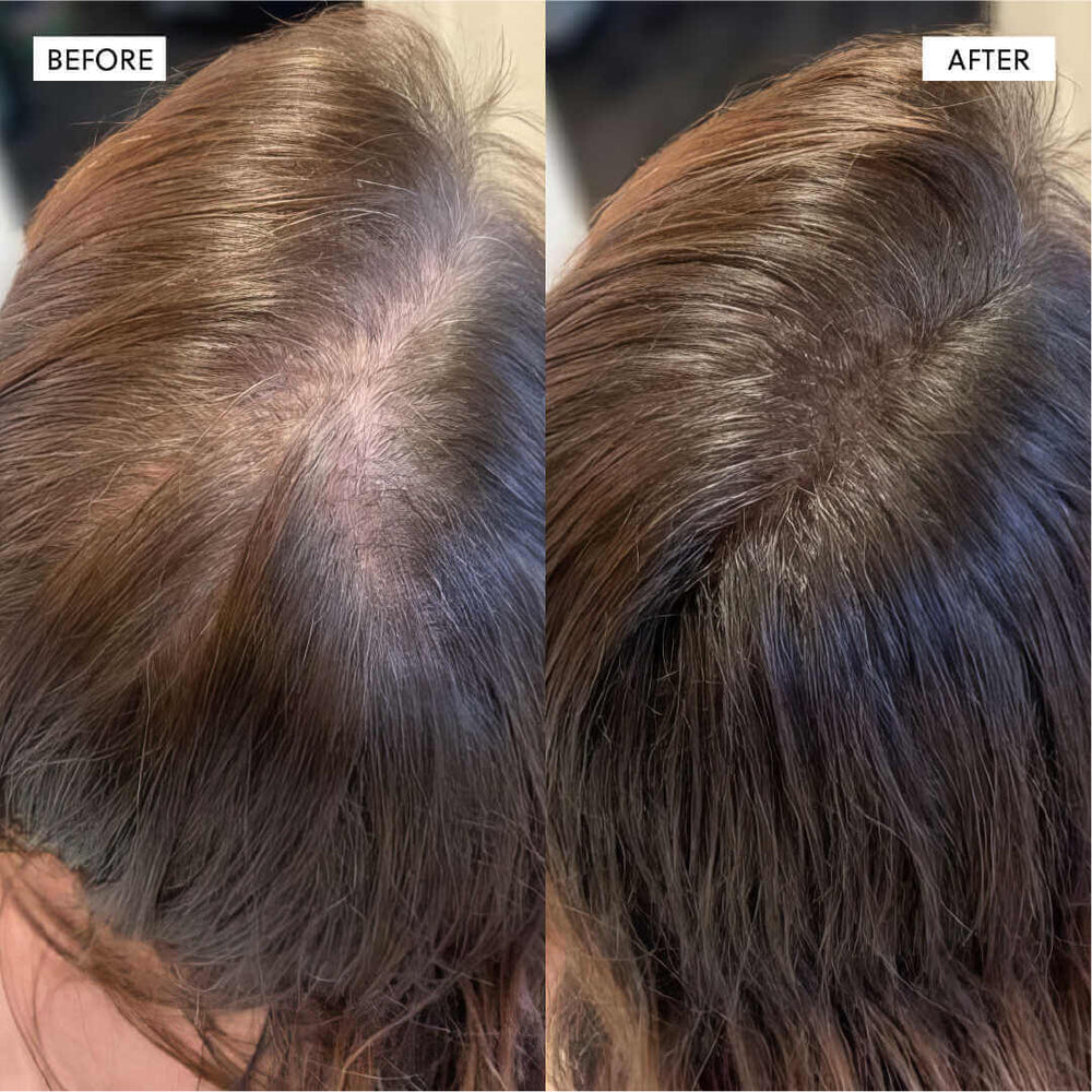 Revive Your Hair Now with Hair Growth Oil Spray | ForChics