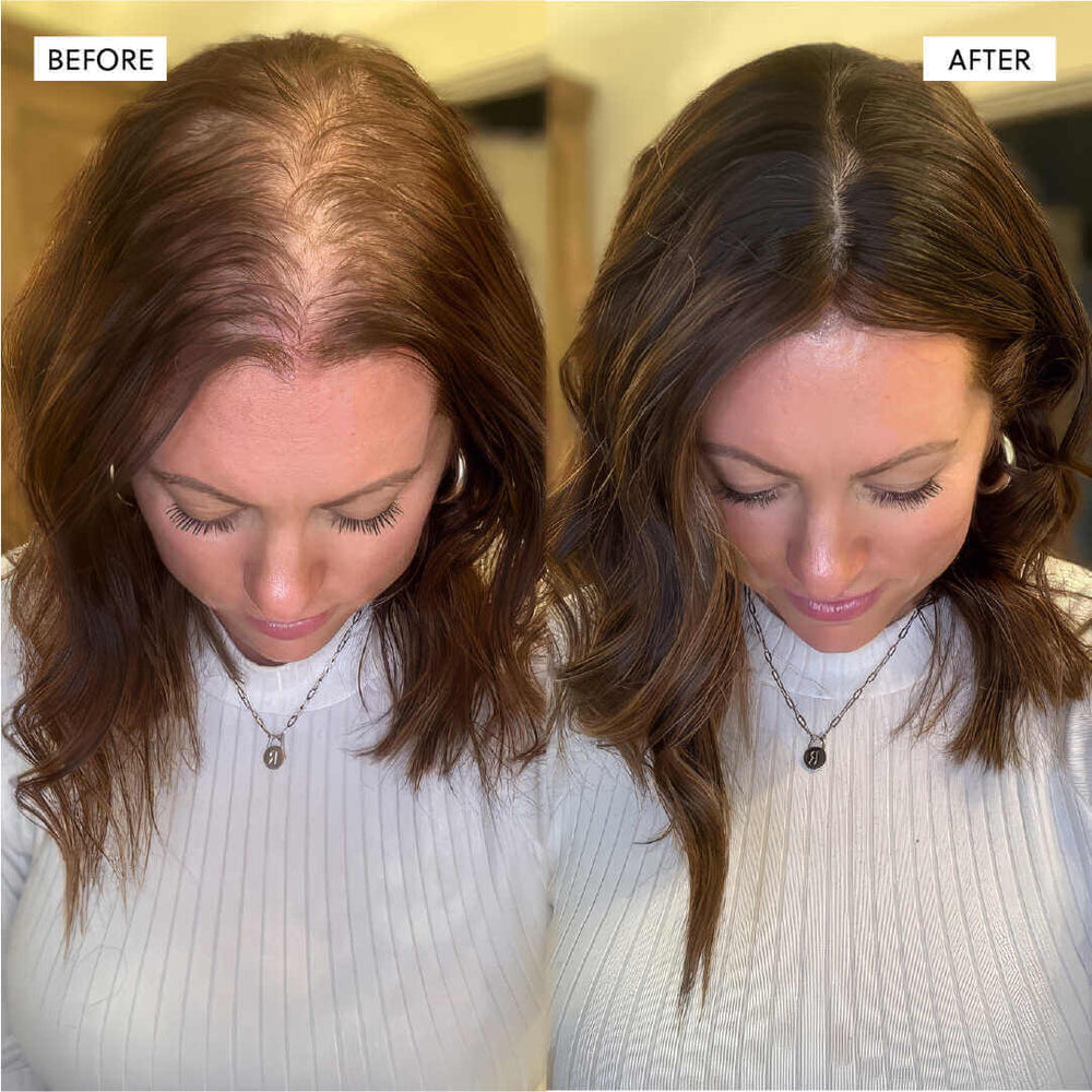 Revive Your Hair Now with Hair Growth Oil Spray | ForChics