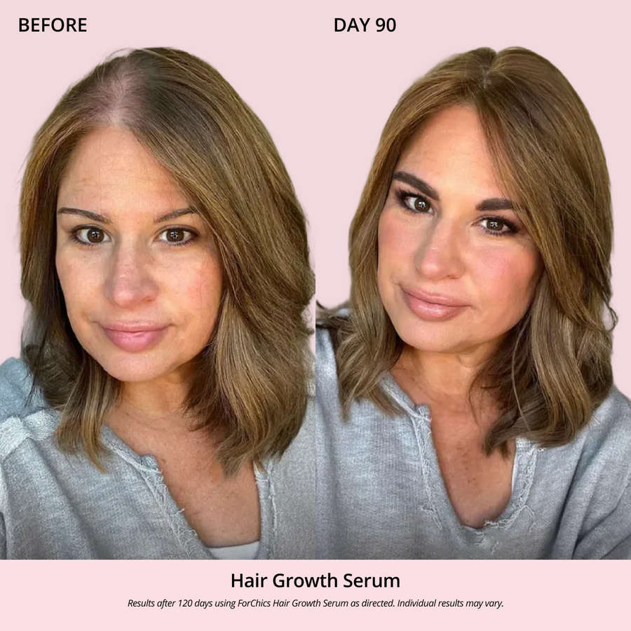 Revive Your Hair Now with Hair Growth Oil Spray | ForChics