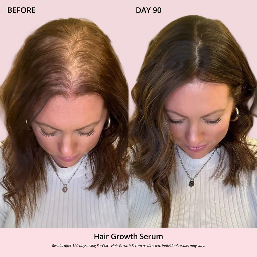 Revive Your Hair Now with Hair Growth Oil Spray | ForChics