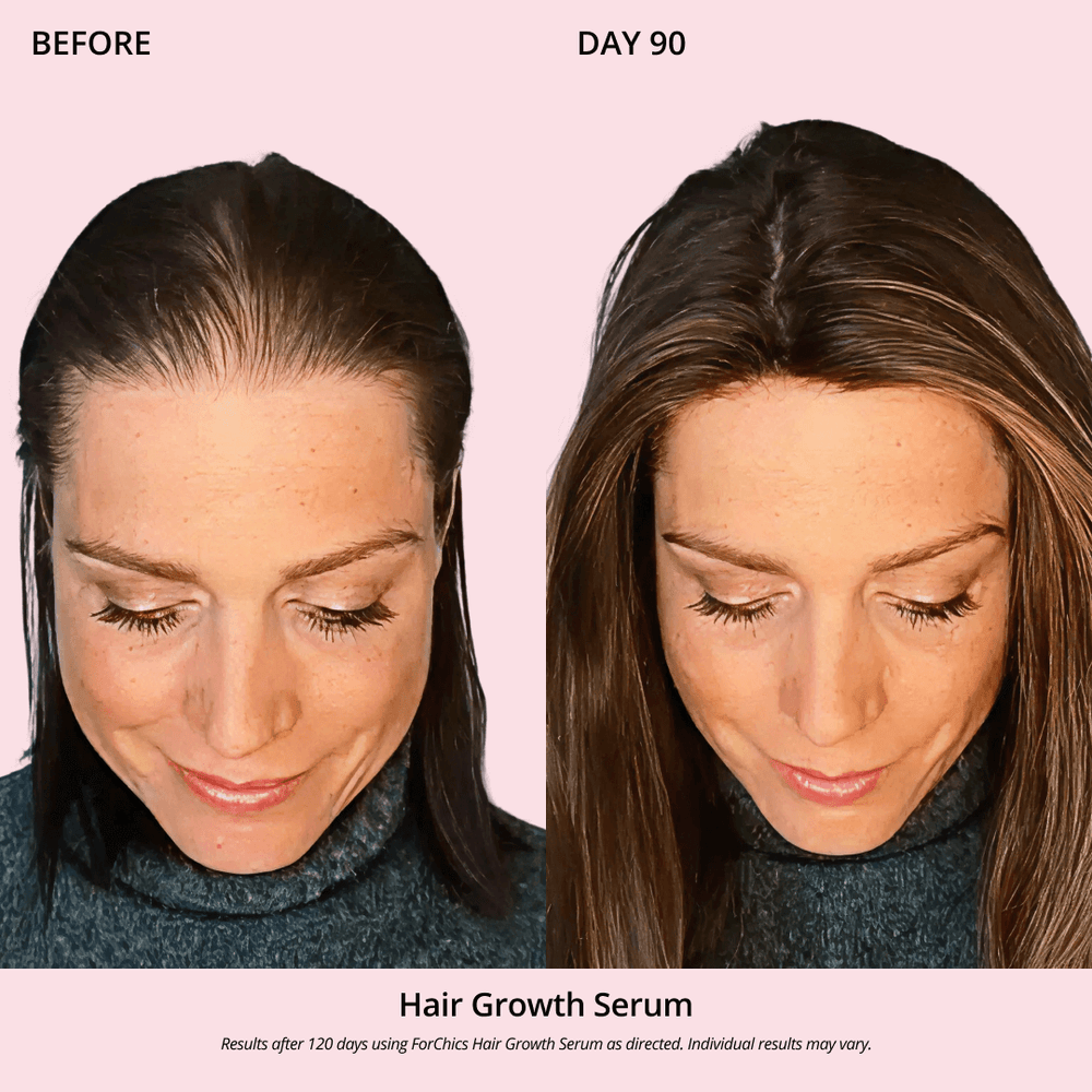 Revive Your Hair Now with Hair Growth Oil Spray | ForChics