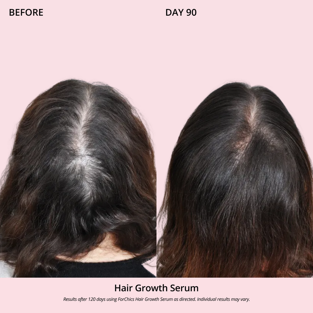 Revive Your Hair Now with Hair Growth Oil Spray | ForChics